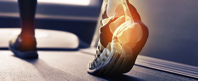 La frattura del malleolo: diagnosi e interventi - Santagostino Magazine