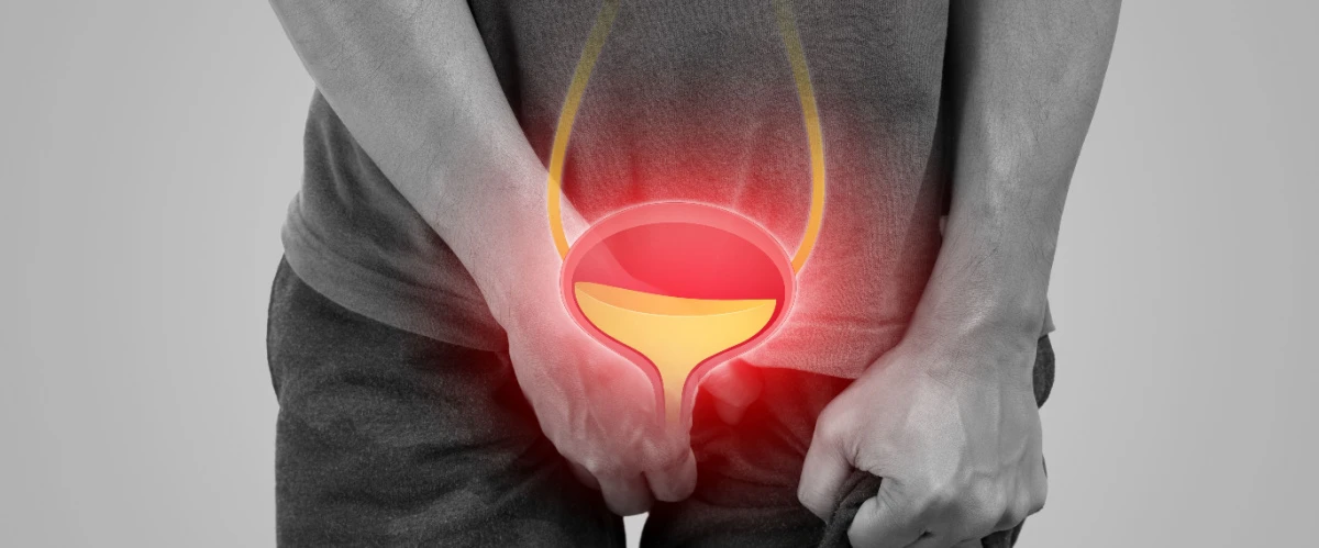 La stranguria - Santagostino Magazine