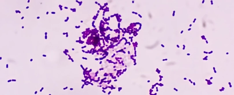 Pneumococco. Cos’è, patologie associate, vaccino - Santagostino Magazine