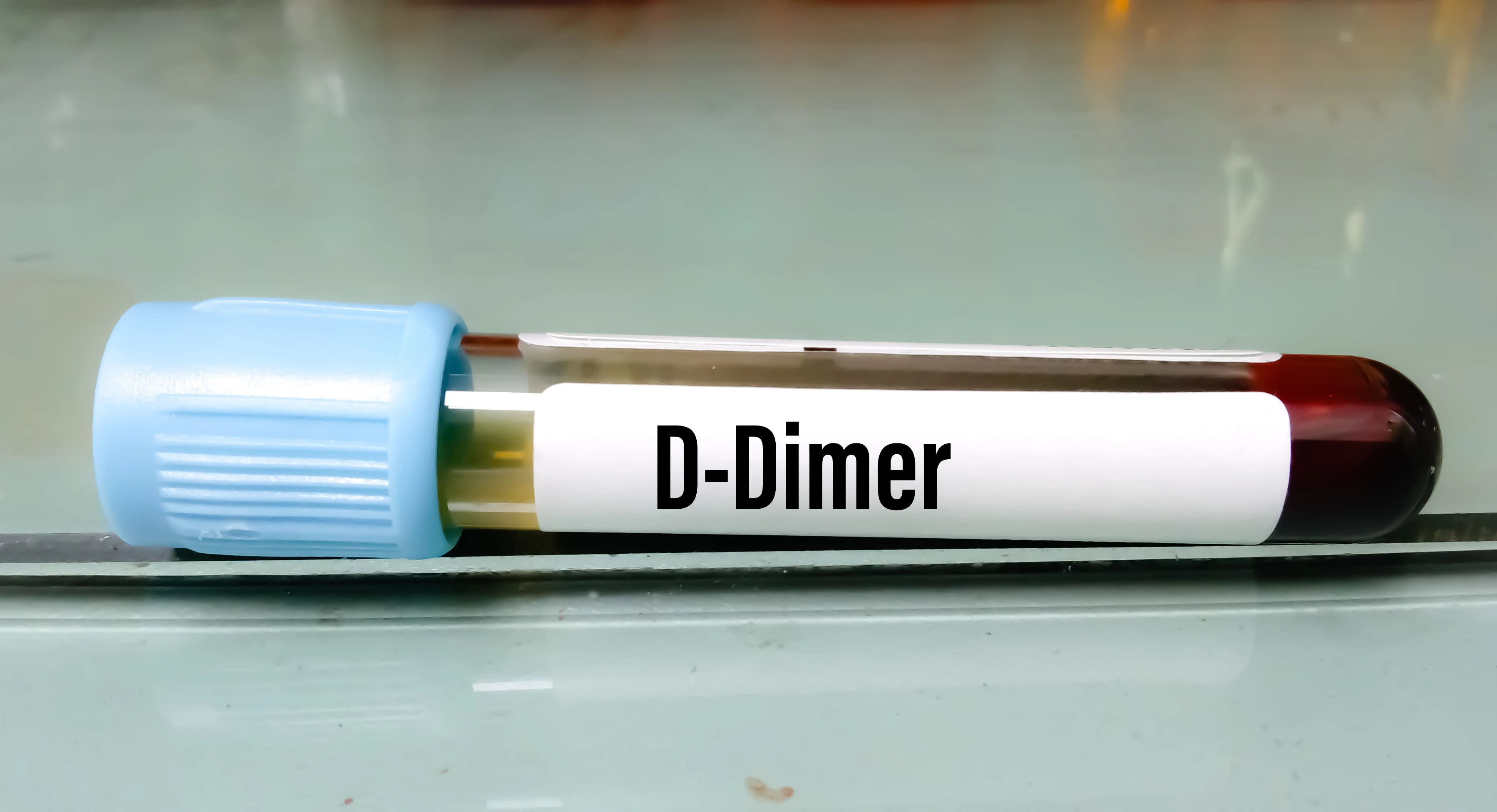 Il D-Dimero, come funziona il test per rilevarlo - Santagostino Magazine